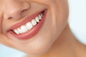 Traits of a Beautiful Smile l Dentist in San Antonio l Brice Dental